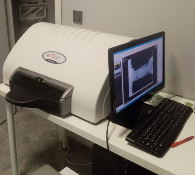 Secondhand Kodak Orex PcCR 1417 ACL4 CR Device - Medbidding