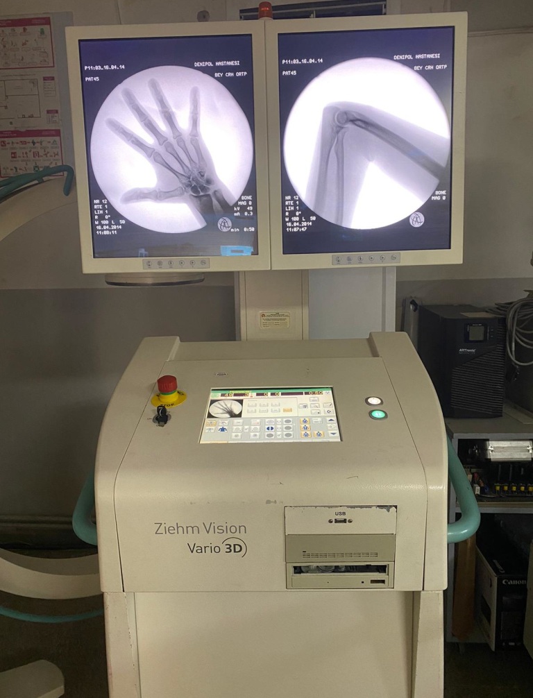 Secondhand Ziehm Vision Vario 3D Fluoroscopy C-Arm X-Ray Device - Medbidding